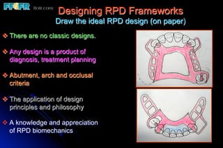 7.designing rpd's, planning sequence for rpd patients | PDF