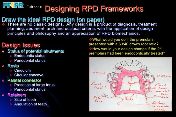 7.designing rpd's, planning sequence for rpd patients