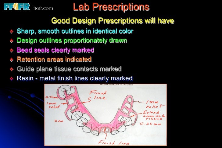 7.designing rpd's, planning sequence for rpd patients