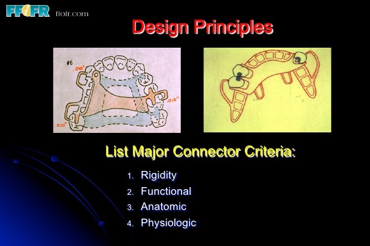 7.designing rpd's, planning sequence for rpd patients