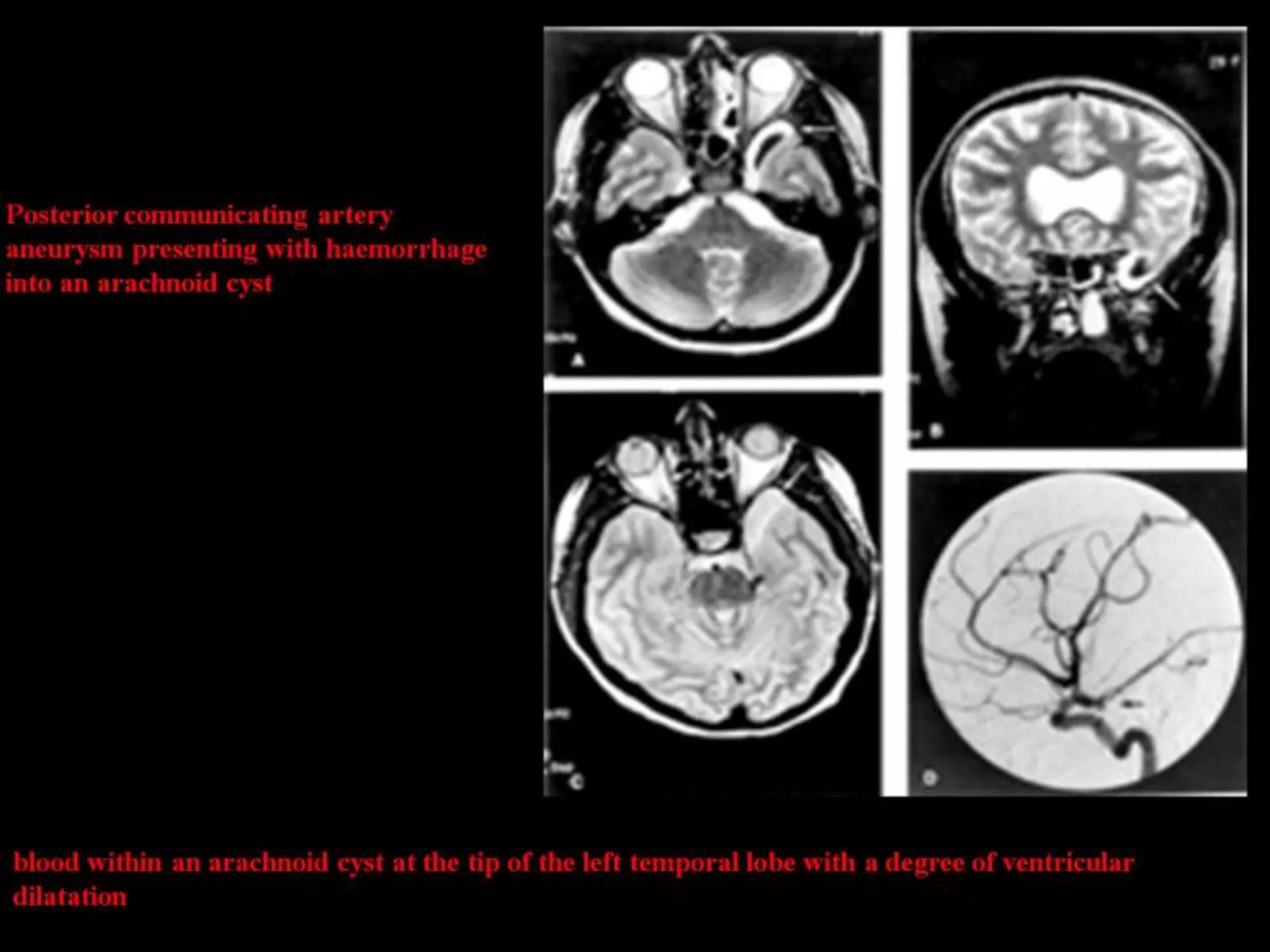 7 Dr Ahmed Esawy channel imaging oral board of CNS BRAIN part VII ...