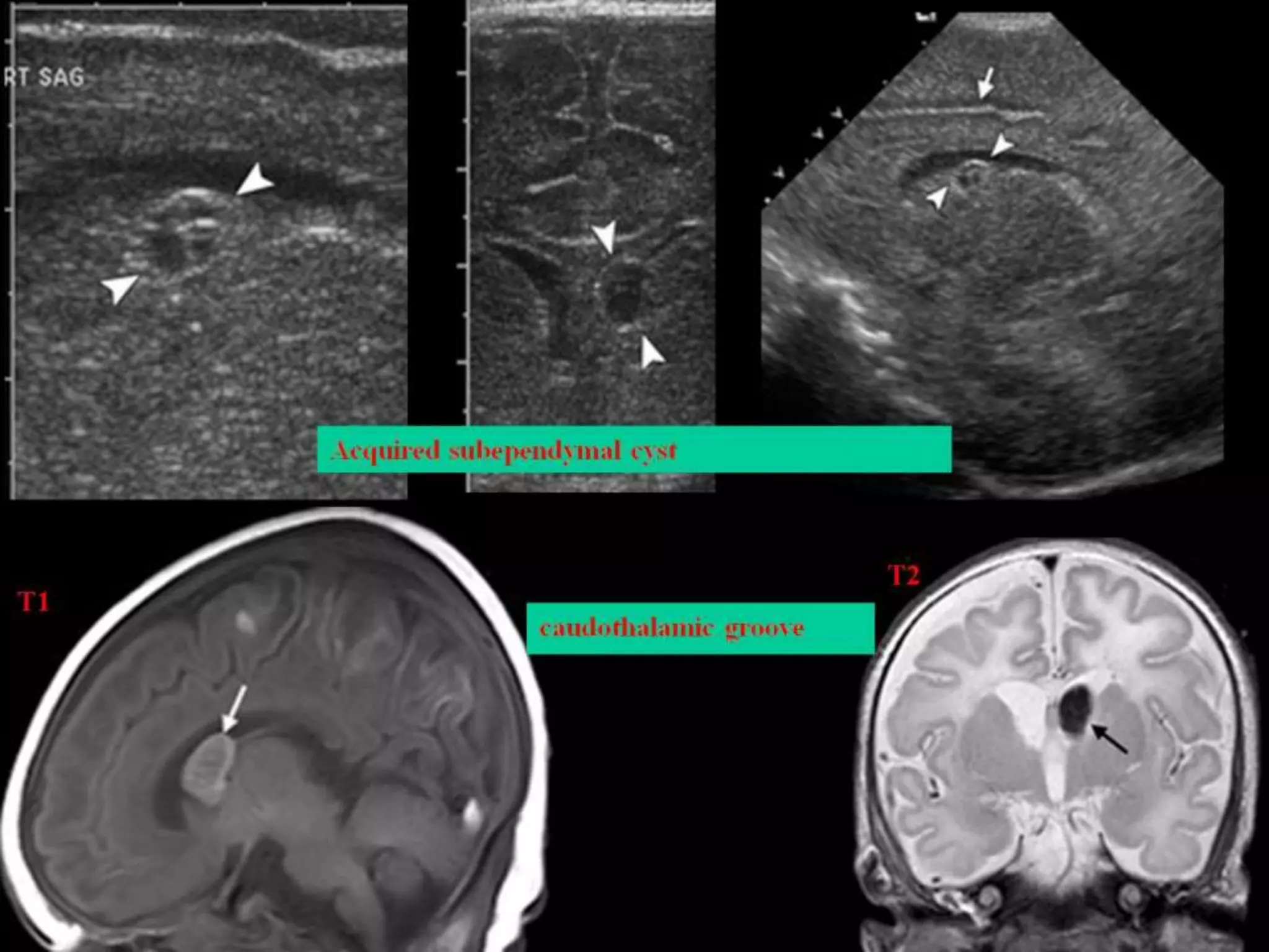 7 Dr Ahmed Esawy channel imaging oral board of CNS BRAIN part VII ...