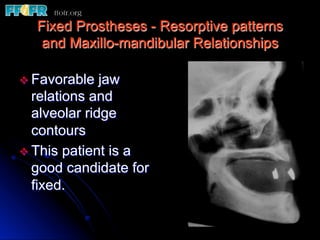Edentulous Maxilla - Fixed Prostheses | PDF
