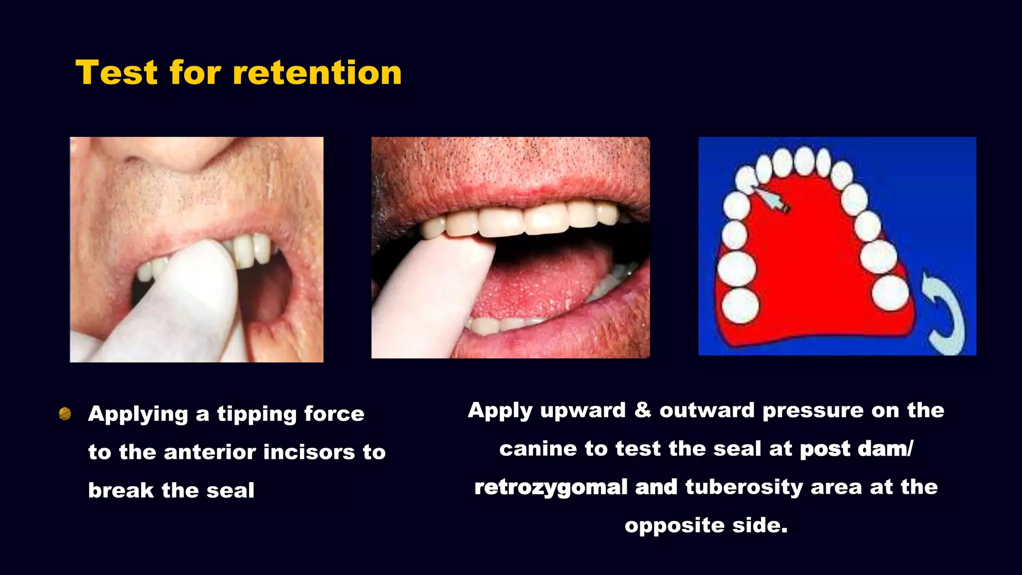 7-Try-in of the wax trial complete denture | PPTX | Dental Health ...