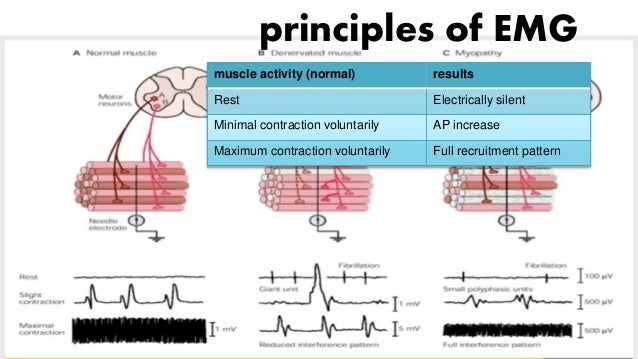 7 electromyoneuronography (emng)