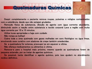 7 - EMERGENCIA - Queimadura.ppt