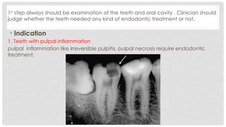 7- Endodontic case fffffv complexity.pptx
