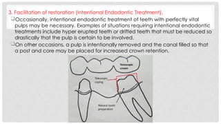 7- Endodontic case fffffv complexity.pptx