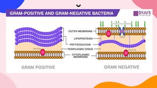 ENDODONTIC MICROBIOLOGY OF ROOT CANAL .pptx