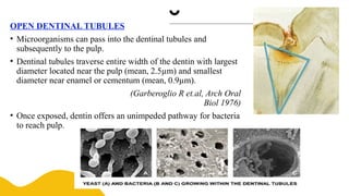 ENDODONTIC MICROBIOLOGY OF ROOT CANAL .pptx