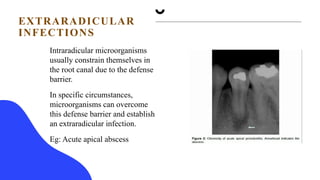 ENDODONTIC MICROBIOLOGY OF ROOT CANAL .pptx