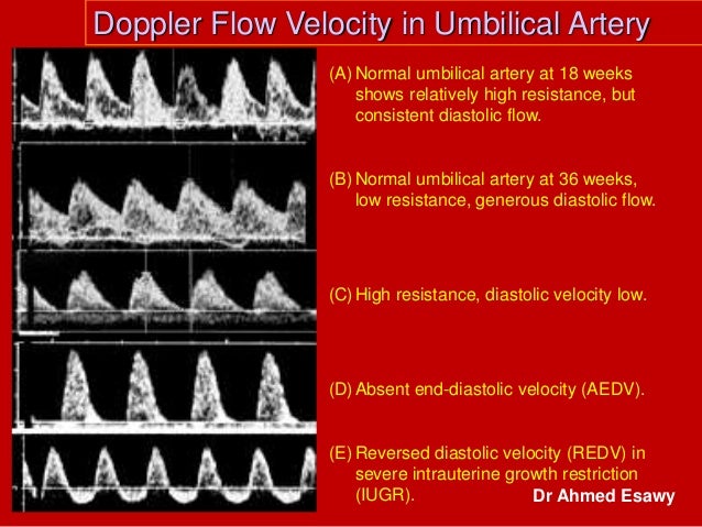 7-Fetal growth restriction part 1 Dr Ahmed Esawy