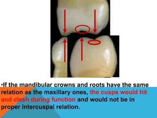Geometric outline of teeth | PPTX