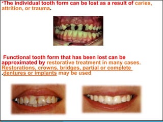 Geometric outline of teeth | PPTX
