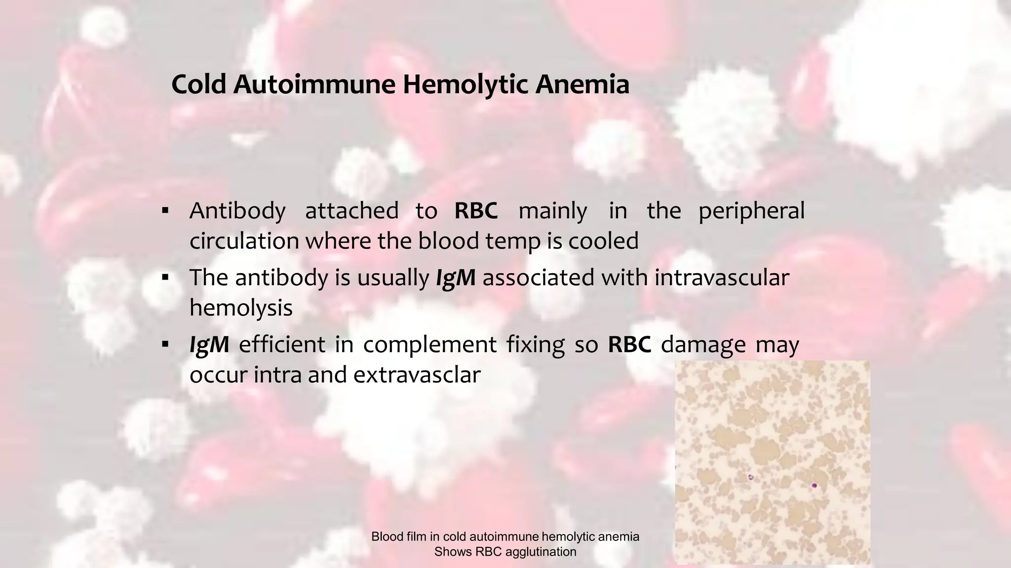 7-Haemolytic anaemias a sub-type of anemia, a common blood disorder .pdf
