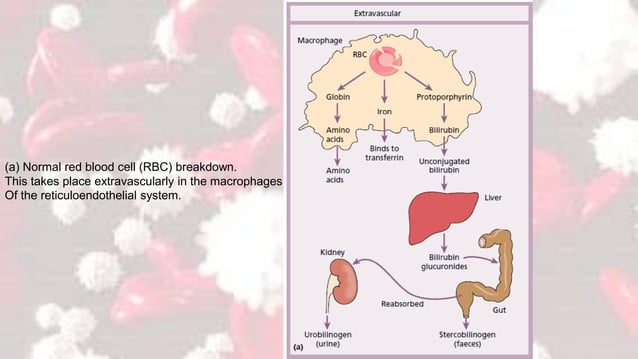7-Haemolytic anaemias a sub-type of anemia, a common blood disorder .pdf