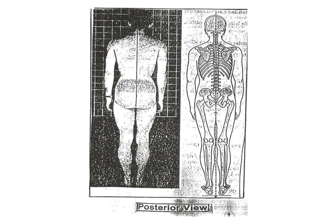 Human Posture | PPT