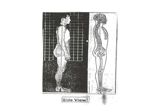 Human Posture | PPT