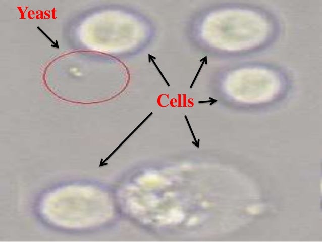 bacillus contamination cell culture