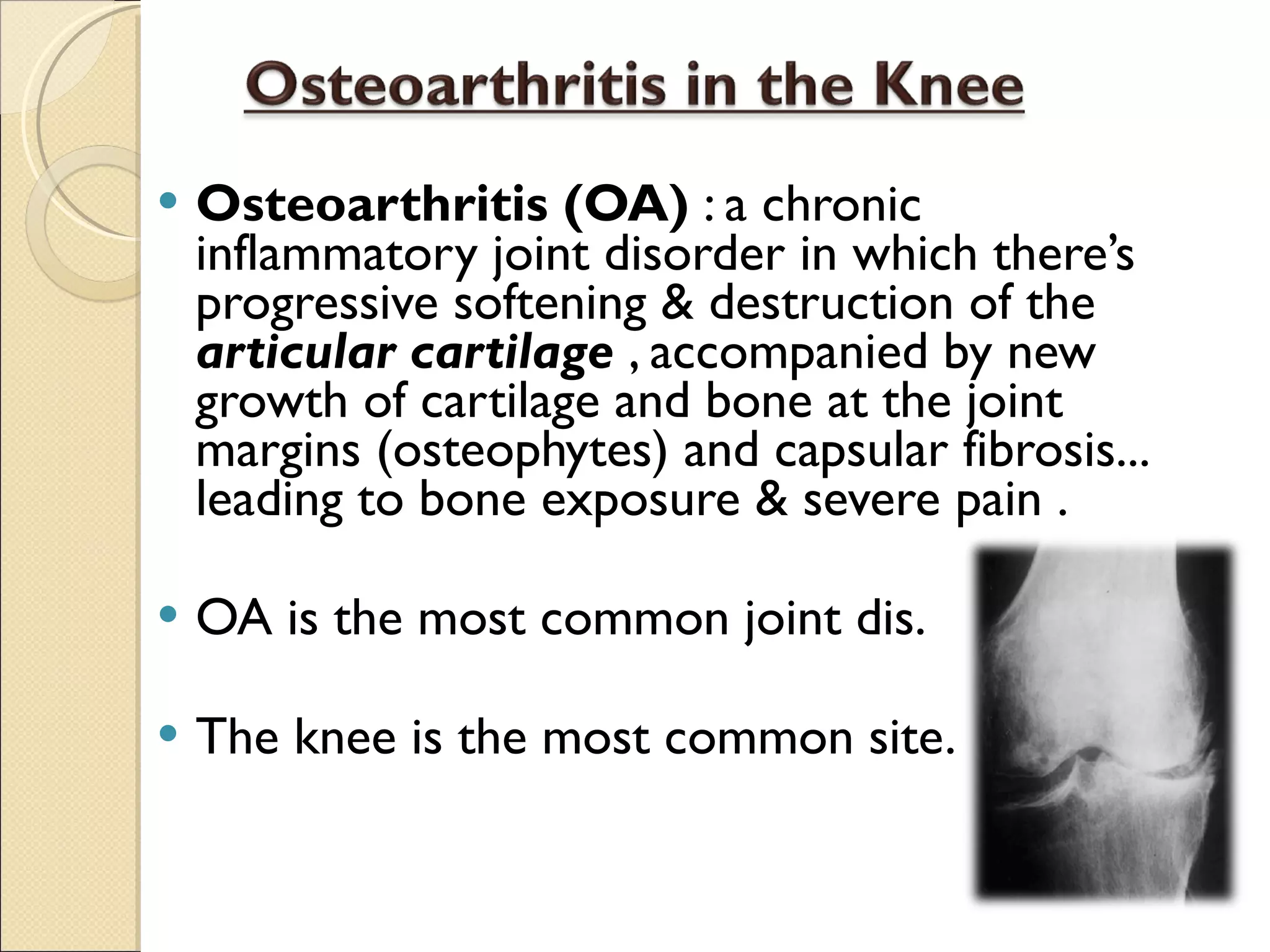 Knee Joint anatomy and Disorders | PPT