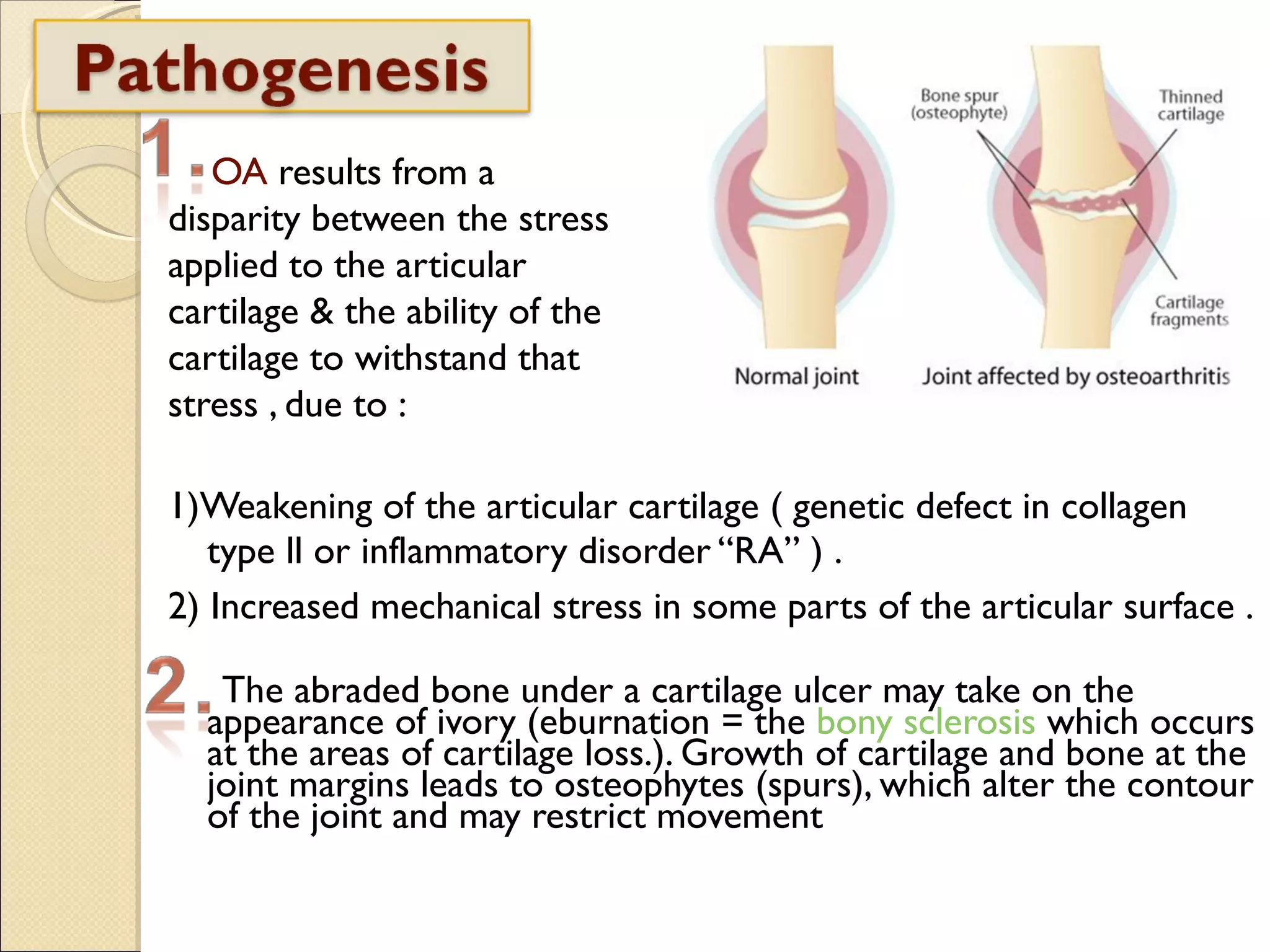 Knee Joint anatomy and Disorders | PPT
