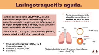 LARINGITIS, BRONQUITIS Y NEUMONIA EN PEDIATRICOS.pptx