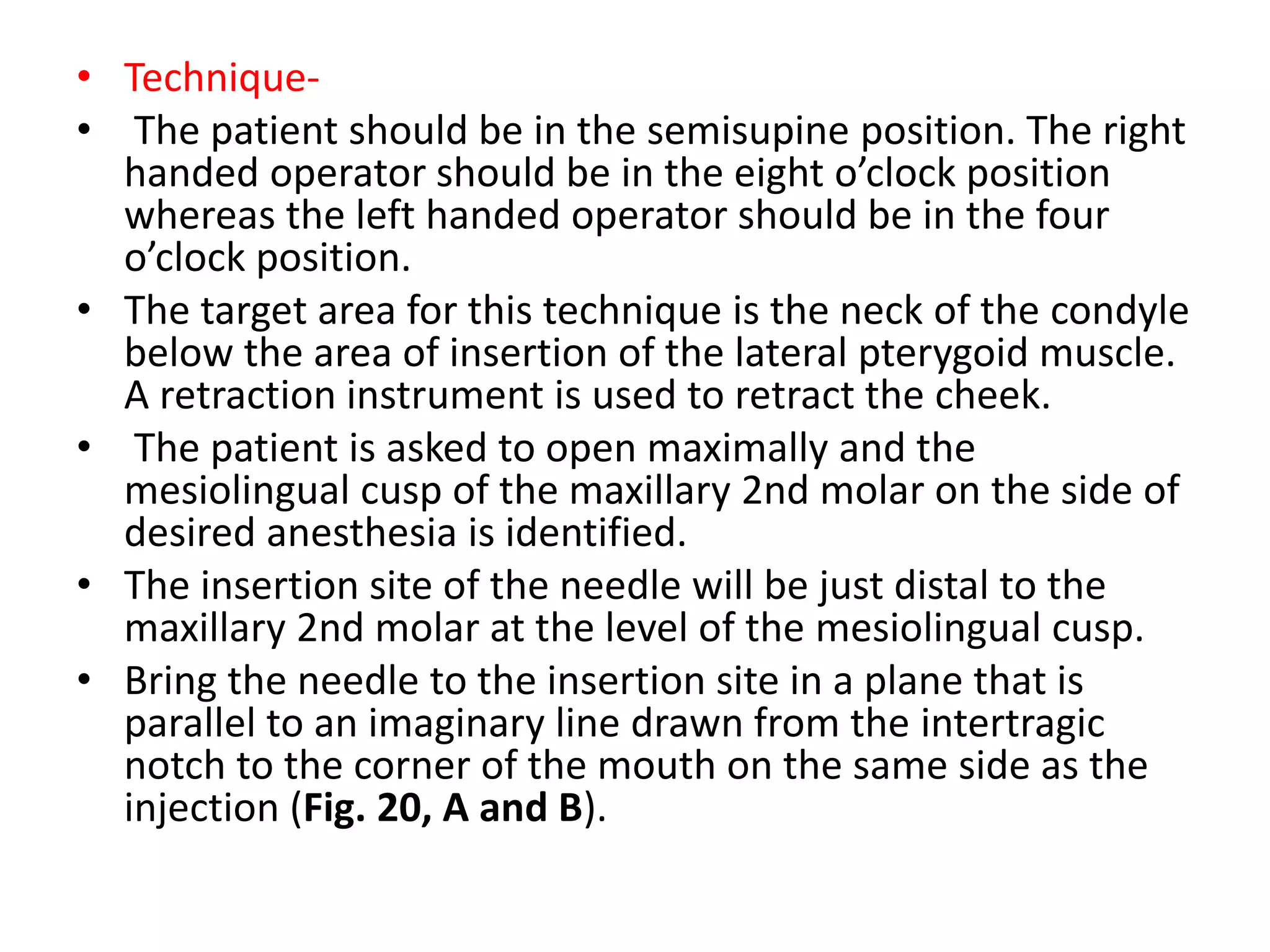 mandibular nerve-block | PPTX