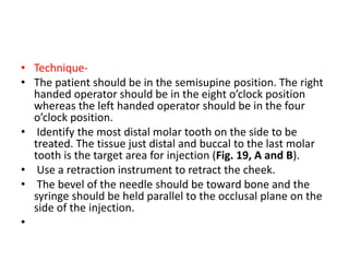 mandibular nerve-block | PPTX