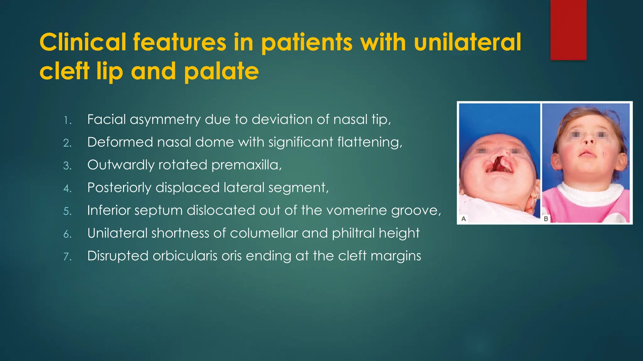 NASO ALVEOLAR MOULDNIG IN CLEFT LIP AND PALATE PATIENT | PPTX