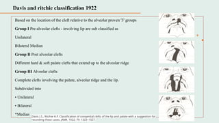 NASO ALVEOLAR MOULDNIG IN CLEFT LIP AND PALATE PATIENT | PPTX