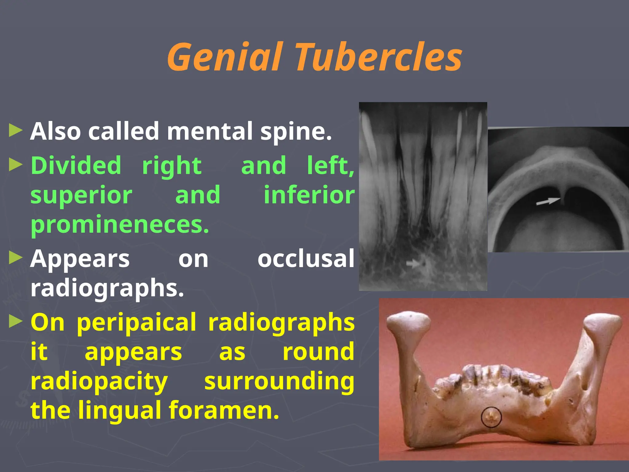7-Normal Radiographic Anatomy-updated..pptx