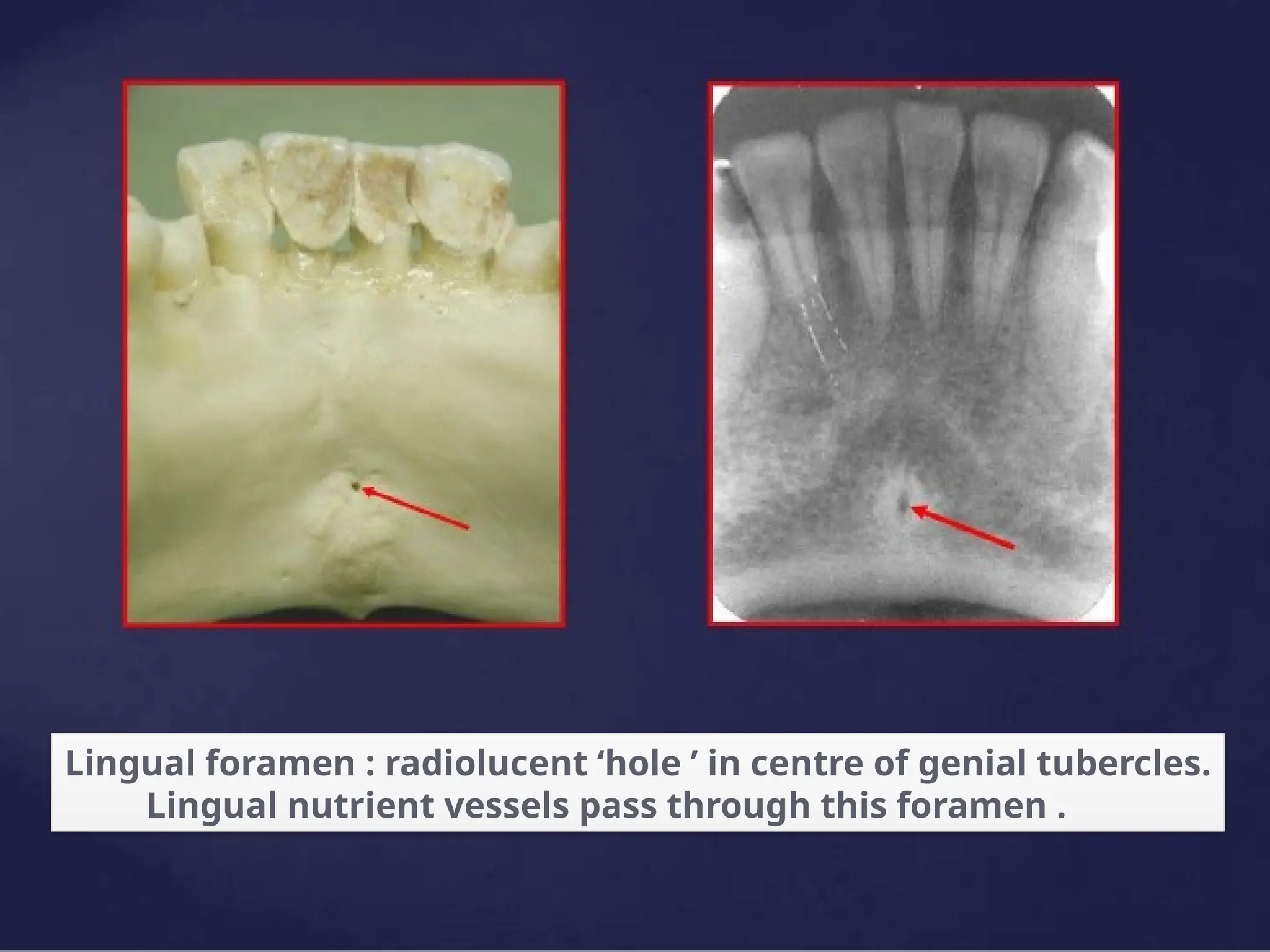 7-Normal Radiographic Anatomy-updated..pptx