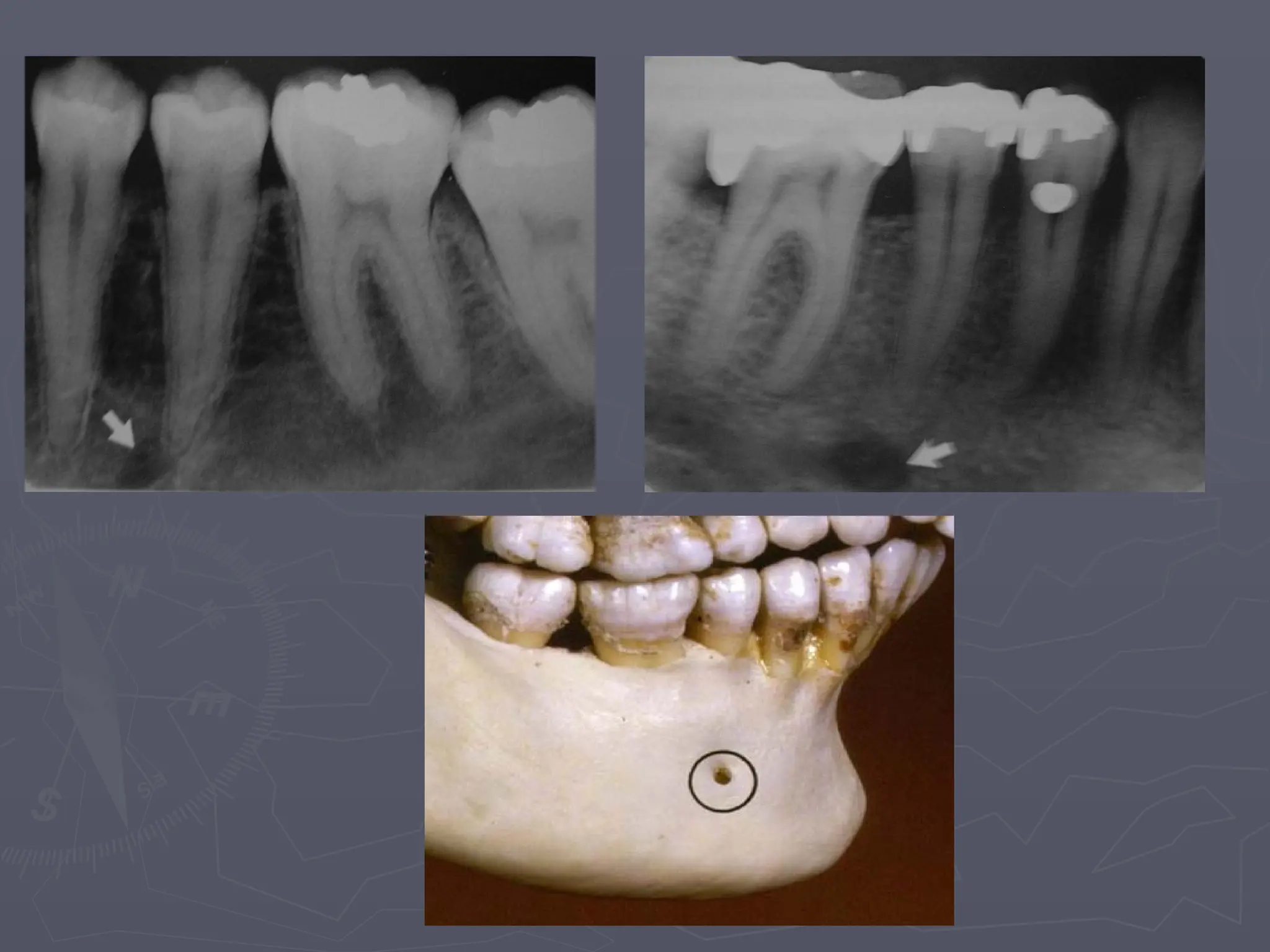 7-Normal Radiographic Anatomy-updated..pptx