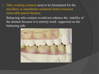 Occlusion in Removable Partial Dentures | PPTX