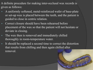 Occlusion in Removable Partial Dentures | PPTX