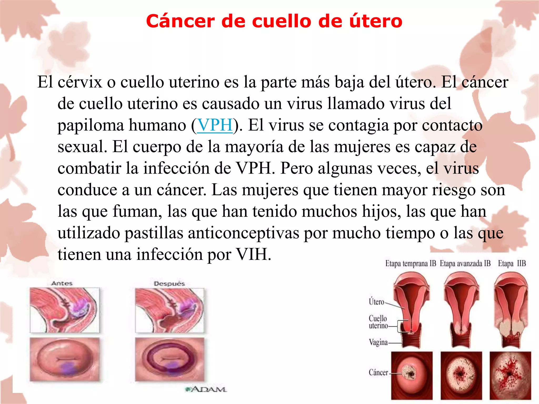 patologías de utero o matriz | PPTX
