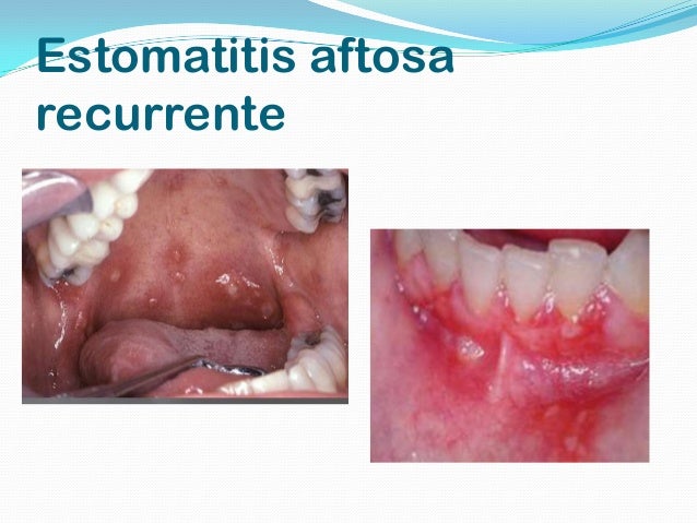 7. patologia oral en el paciente pediatrico