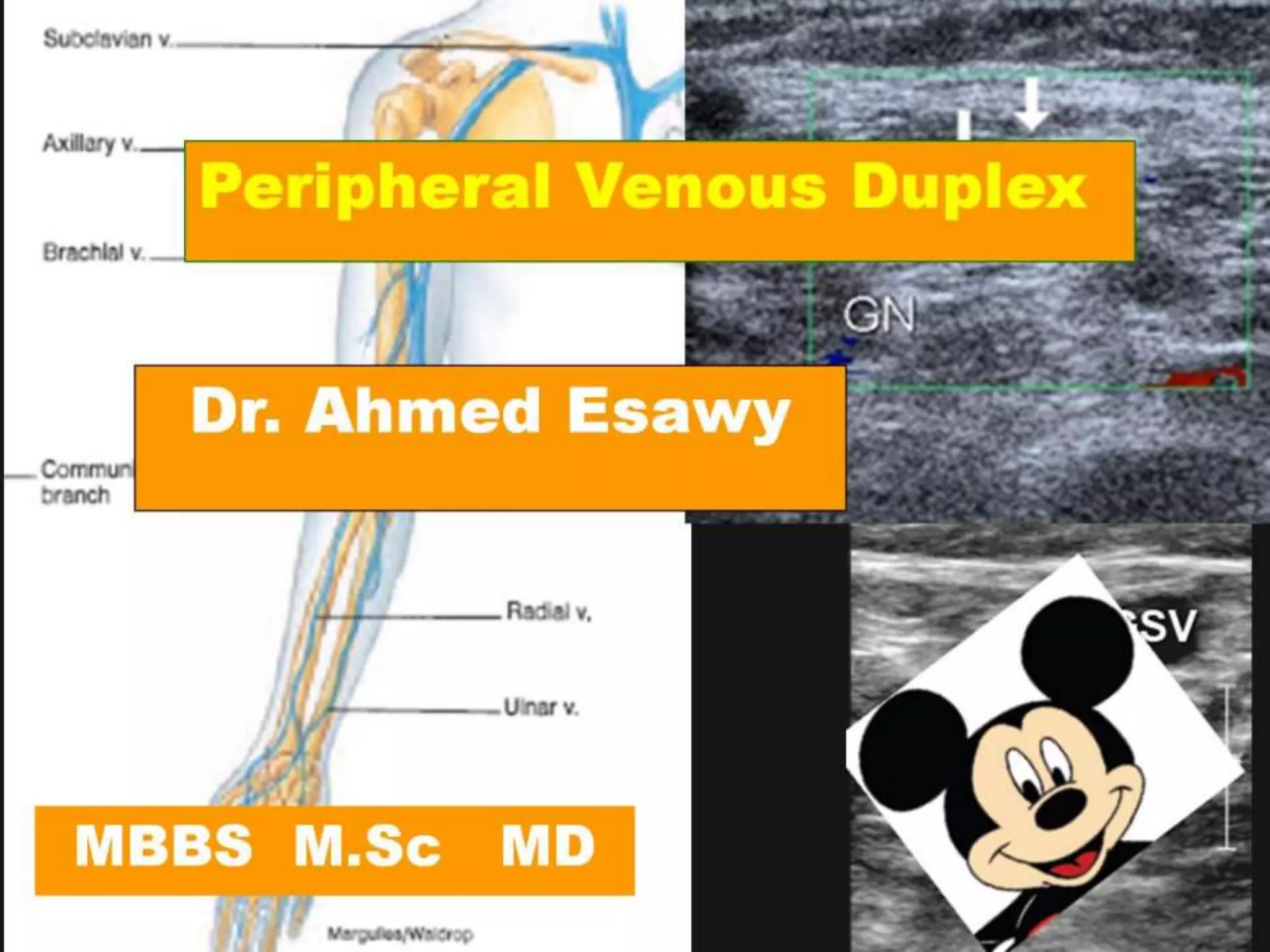 7 peripheral venous duplex perforating veins anatomy dr ahmed esawy | PPTX