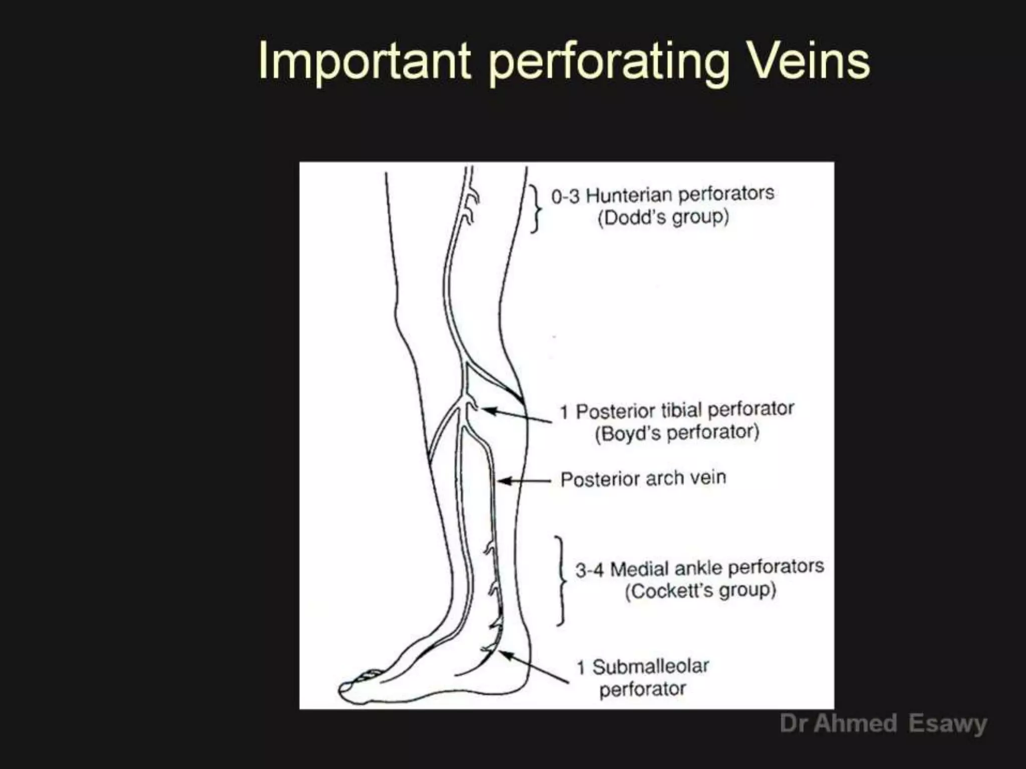 7 peripheral venous duplex perforating veins anatomy dr ahmed esawy | PPT