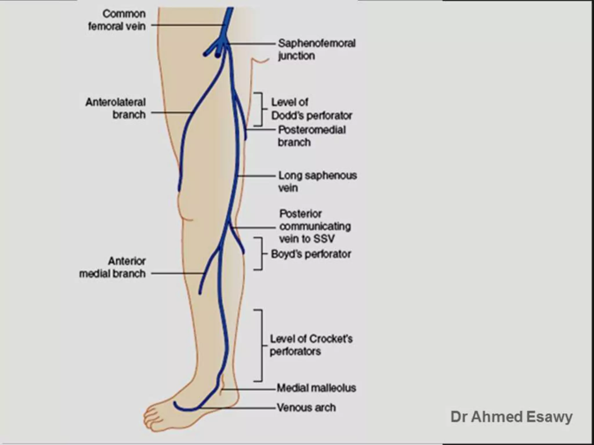 7 peripheral venous duplex perforating veins anatomy dr ahmed esawy | PPT