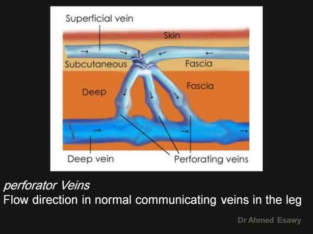 7 peripheral venous duplex perforating veins anatomy dr ahmed esawy | PPTX