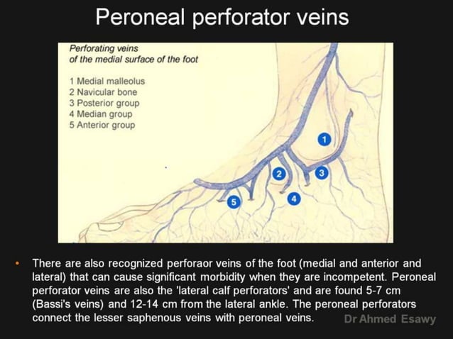 7 peripheral venous duplex perforating veins anatomy dr ahmed esawy | PPTX