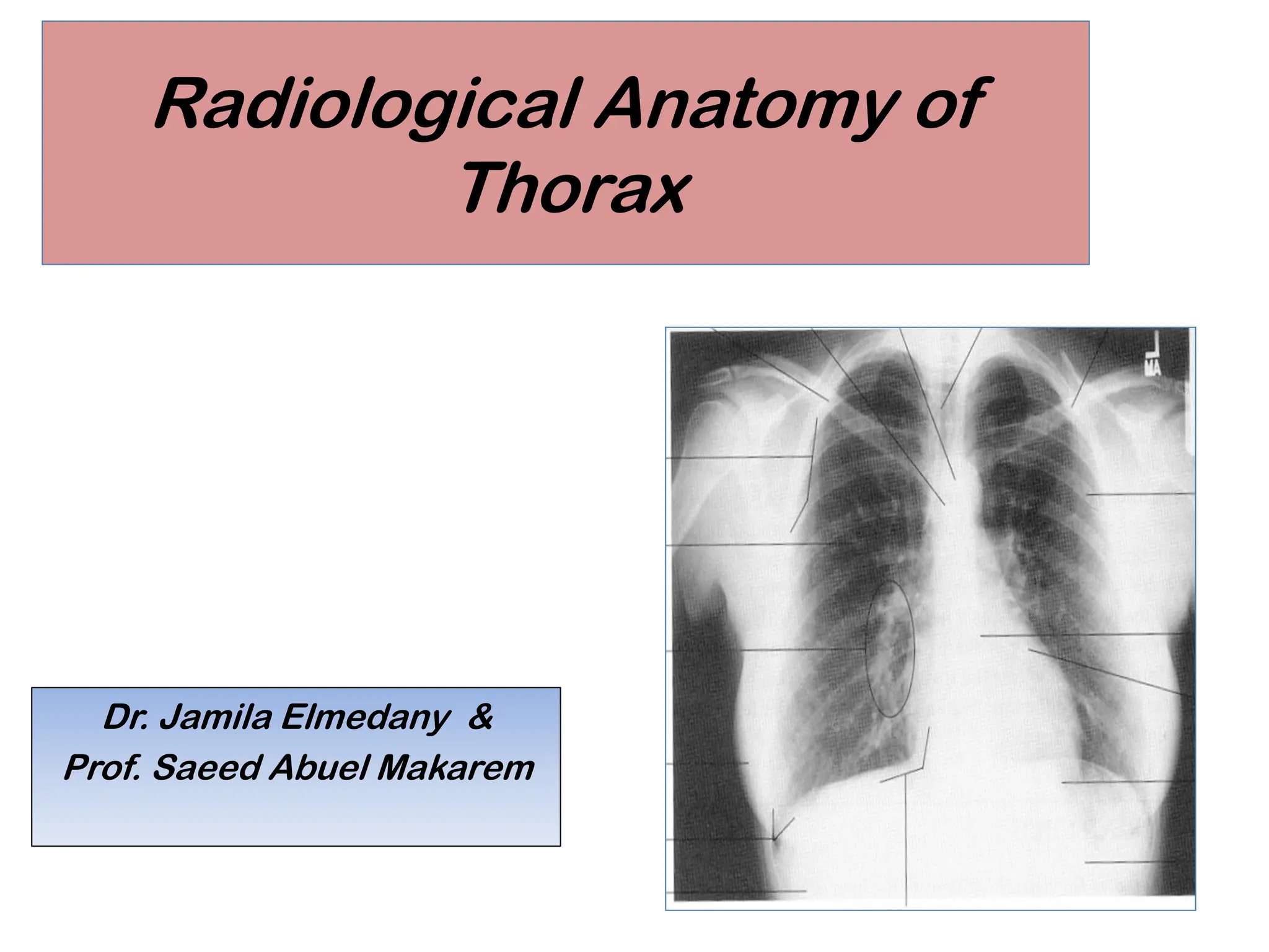 7- Radiological Anatomy of Thorax....pdf