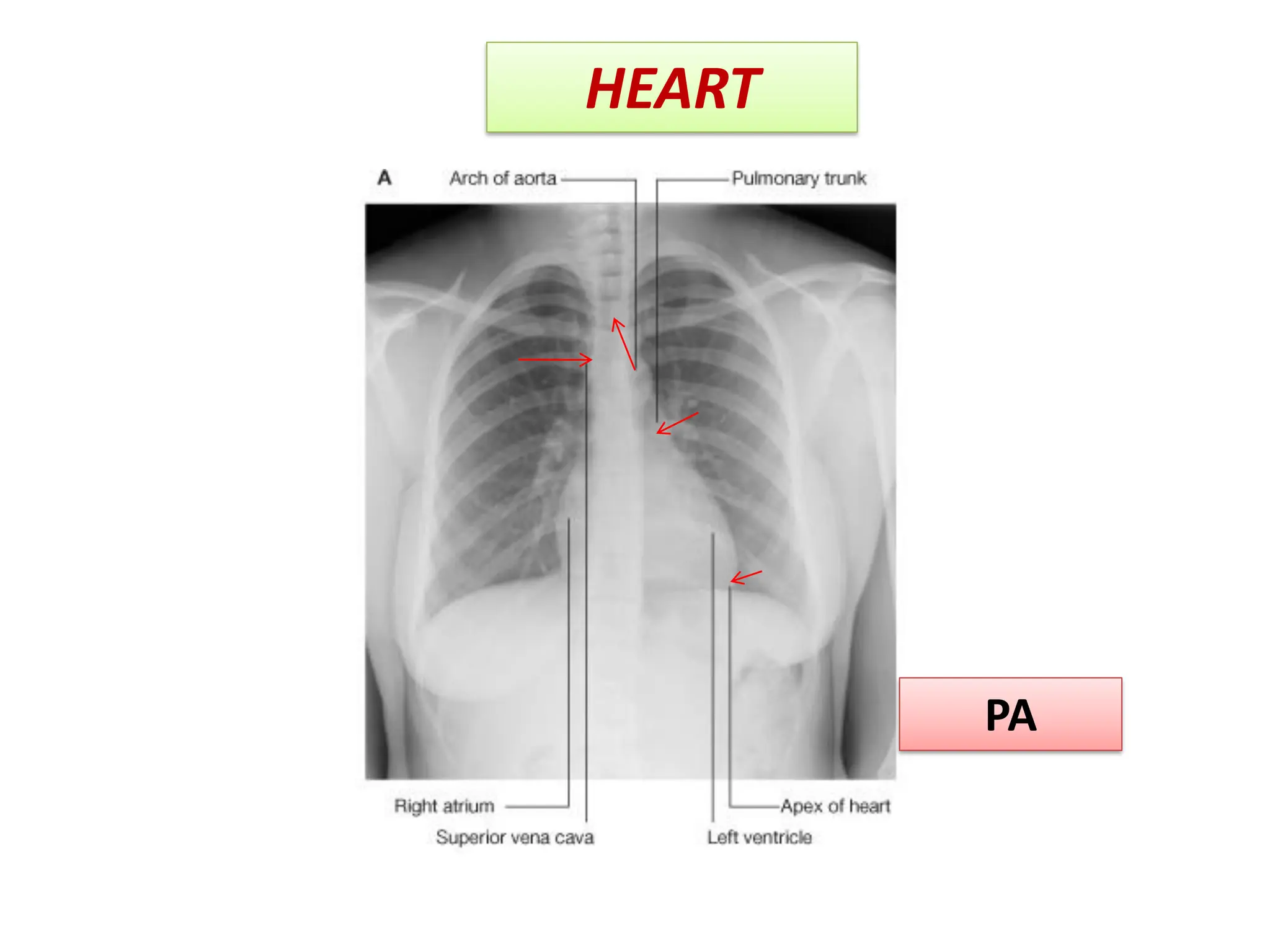 7- Radiological Anatomy of Thorax....pdf