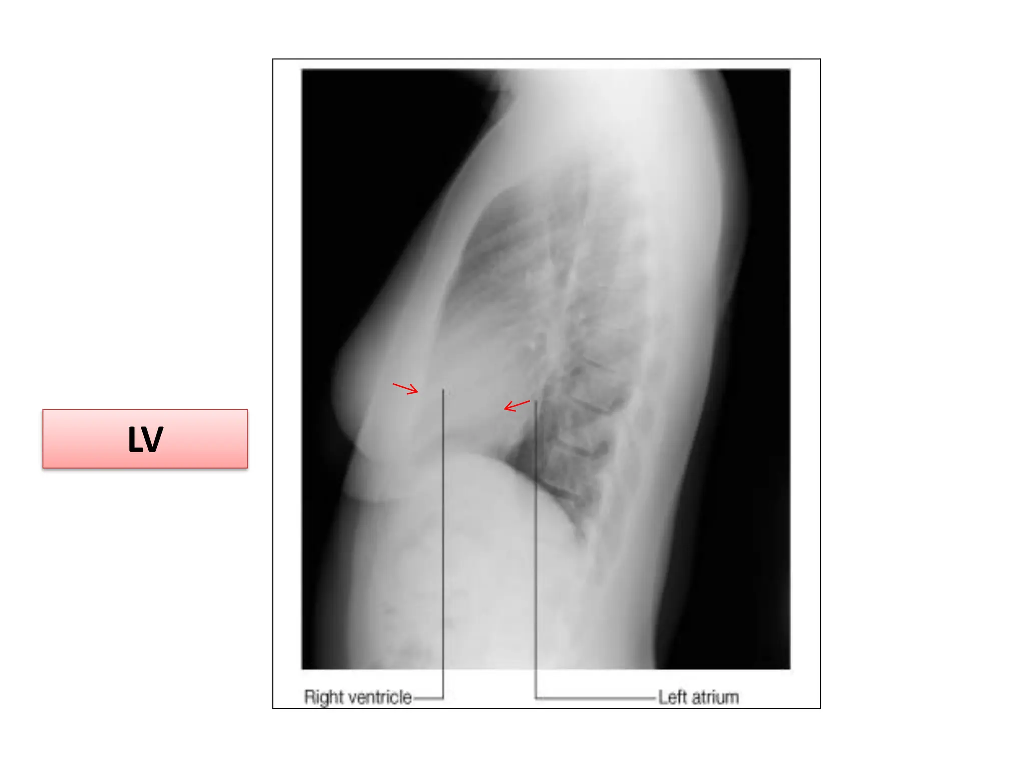 7- Radiological Anatomy of Thorax....pdf