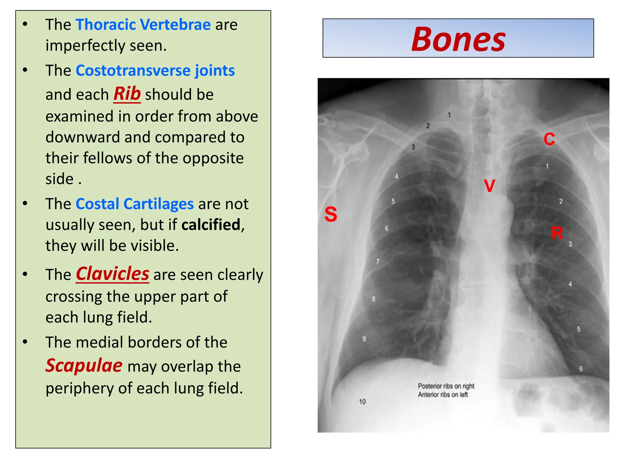 7- Radiological Anatomy of Thorax....pdf