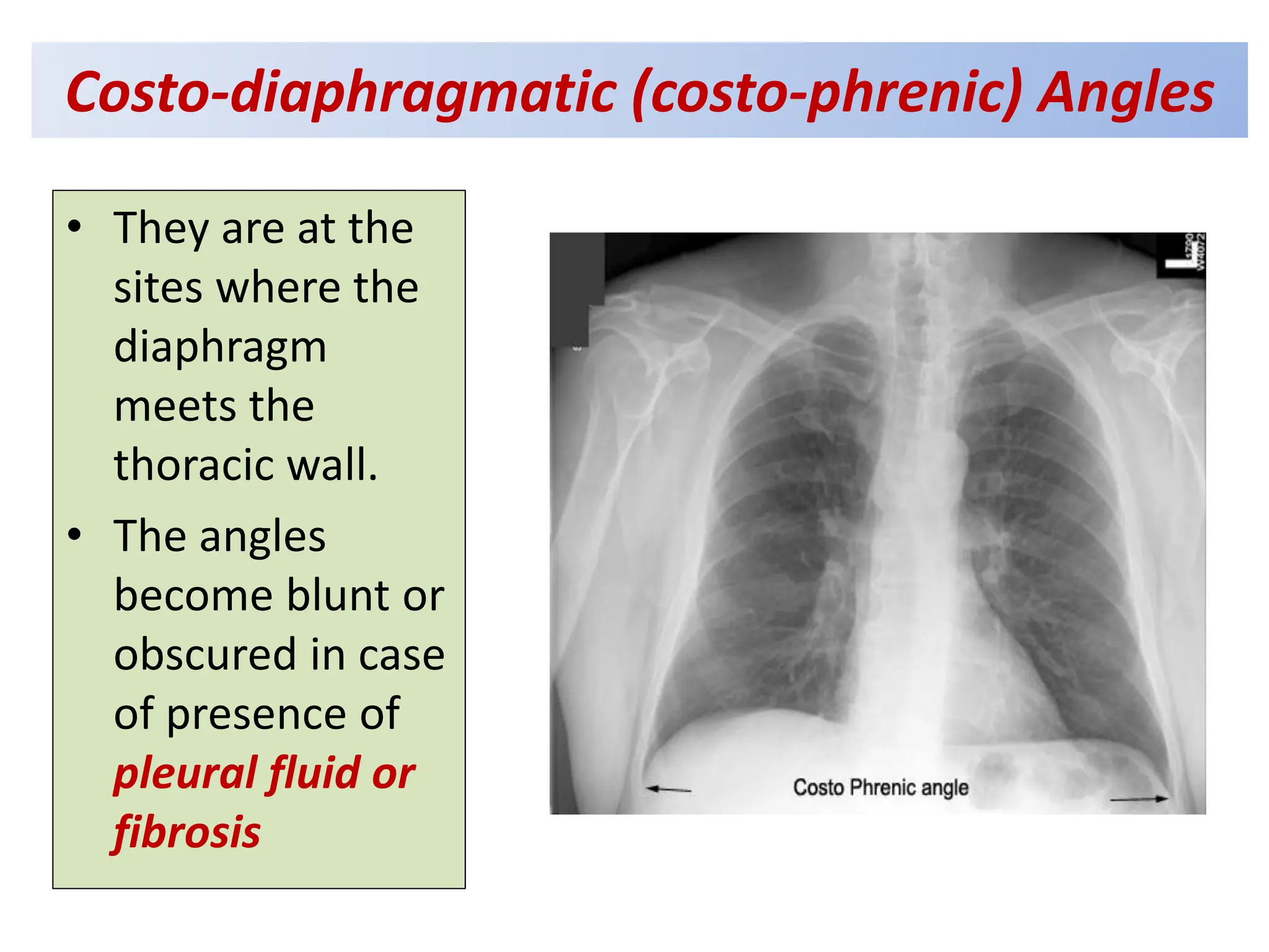 7- Radiological Anatomy of Thorax....pdf