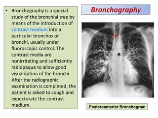 7- Radiological Anatomy of Thorax....pdf