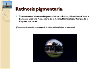 7. retinosis pigmentaria | PPT
