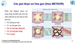 7- ThS Sang - Giá trị của M2BPGI trong xơ gan ở BN HBV - Final.pdf